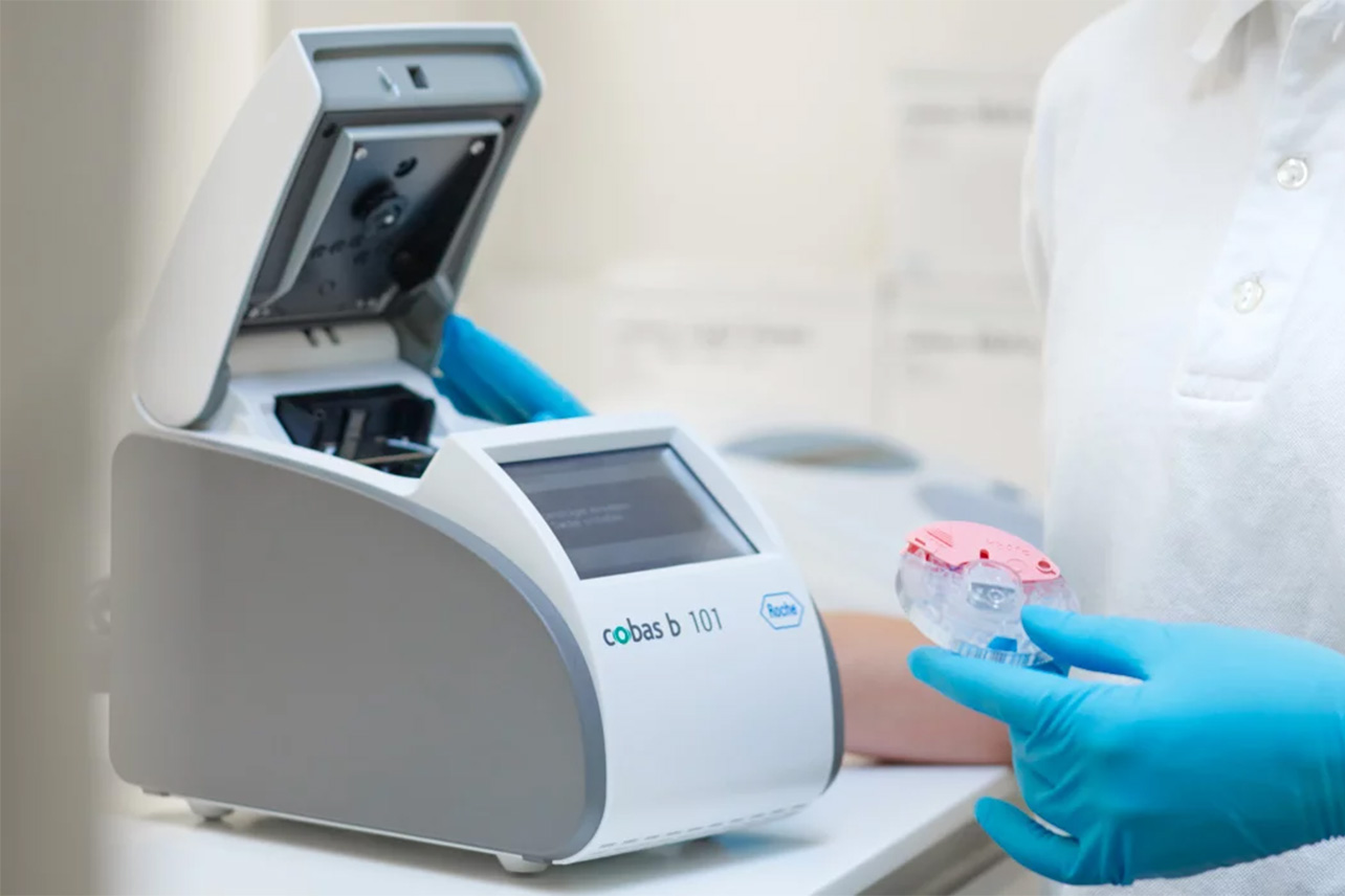 Test de diagnóstico de alzhéimer de Roche recibe autorización en EEUU