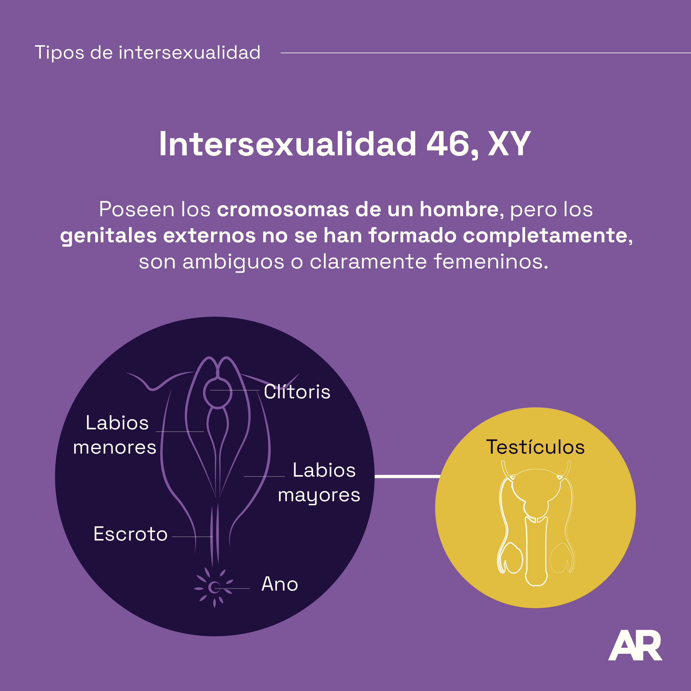 La Intersexualidad c mo Se Ve La Intersexualidad c mo Se Ve